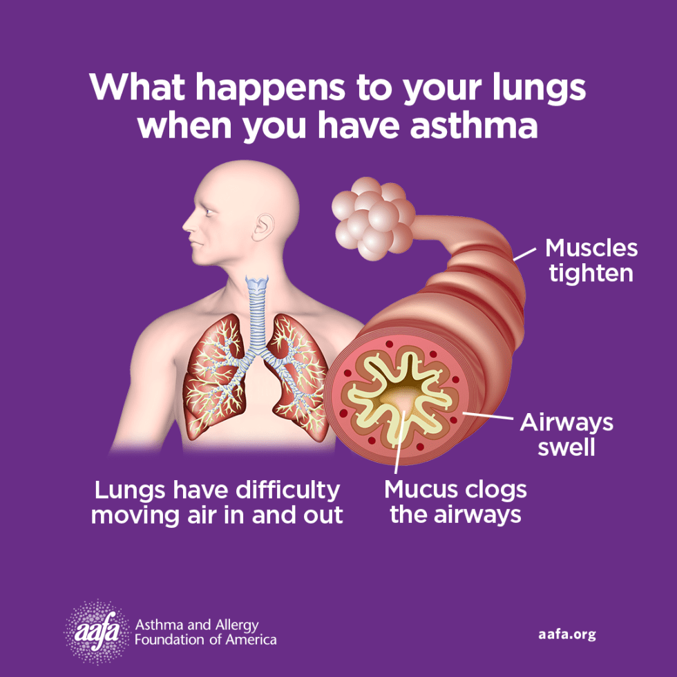 Asthma Diagnosis | AAFA.org
