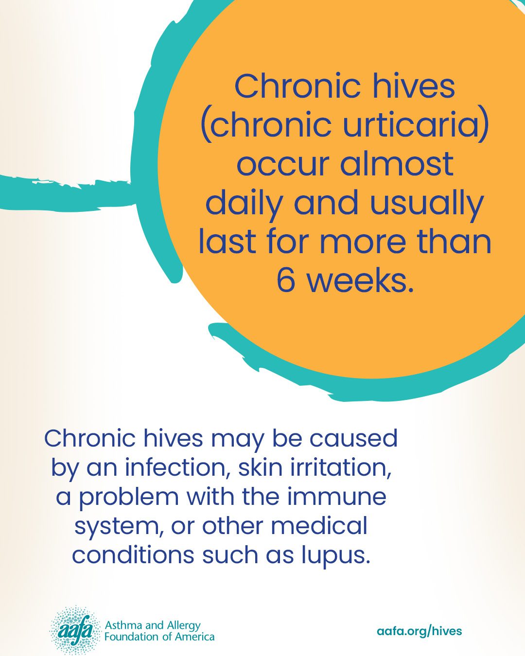 Hives (Urticaria): Know the Facts | Asthma and Allergy Foundation of ...